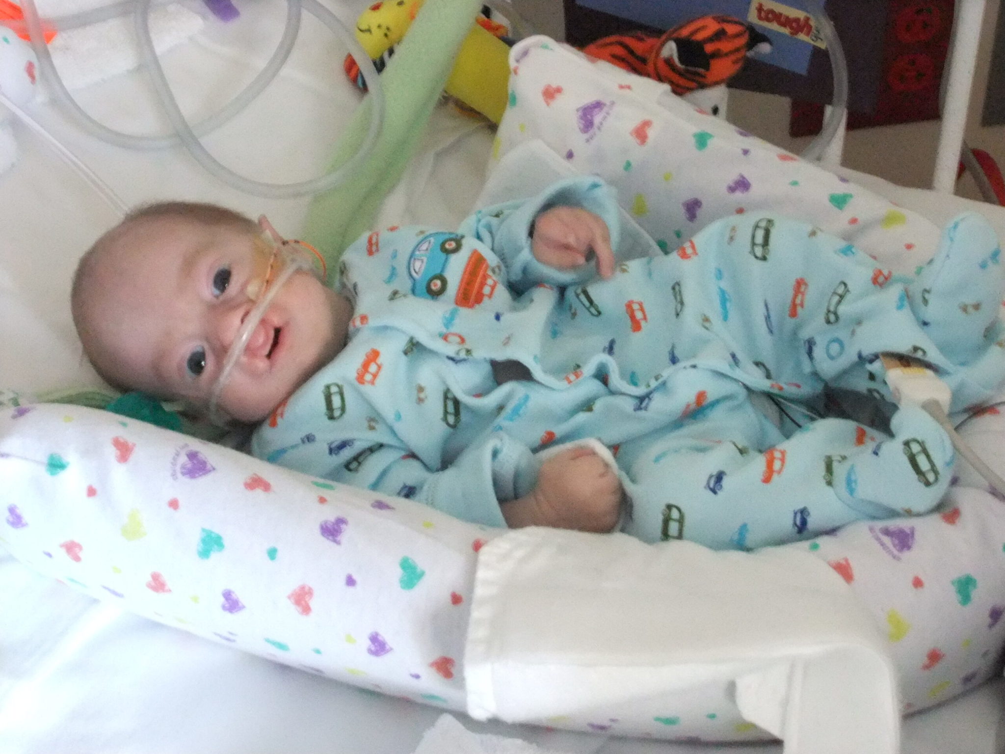 Síndrome de Edwards - Psicología Clínica Infantil